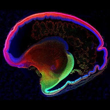 Human Embryo Atlas. Human Fetal Atlas