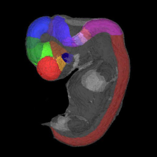 3D human embryo models - OPT