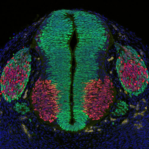 Spinal Cord Briscoe Lab